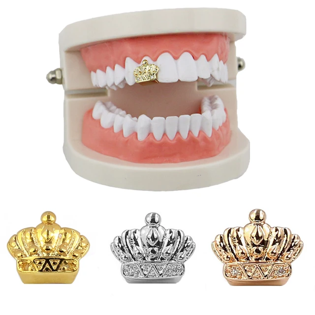 Silver Crown Teeth