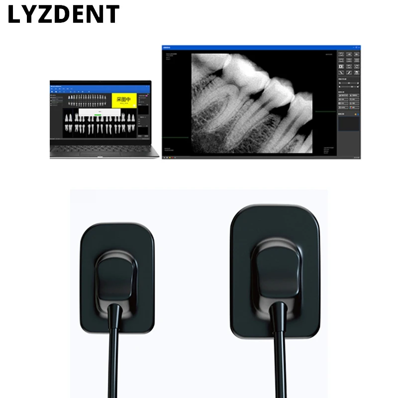 Sensor-Dental-de-alta-frecuencia-para-odontolog-a-sistema-Digital ...