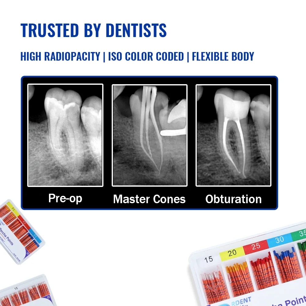 NSKLED Стоматологические точки гуттаперчи GP 02 04 06 F | AliExpress