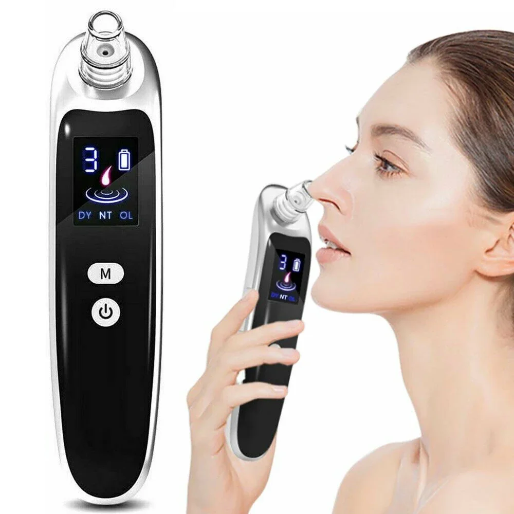 Electric-Blackhead-Remover-Black-Head-Acne-Pimple-Removal-Machine-Face ...