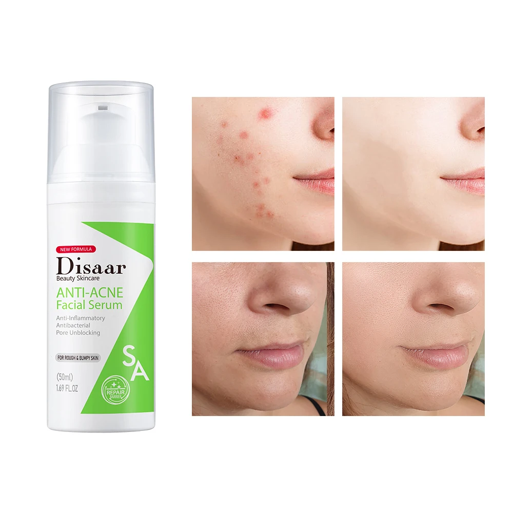 Disaar-Anti-Acne-Serum-50ml-Hyaluronic-Acid-Salicylic-Acid-Ceramide ...
