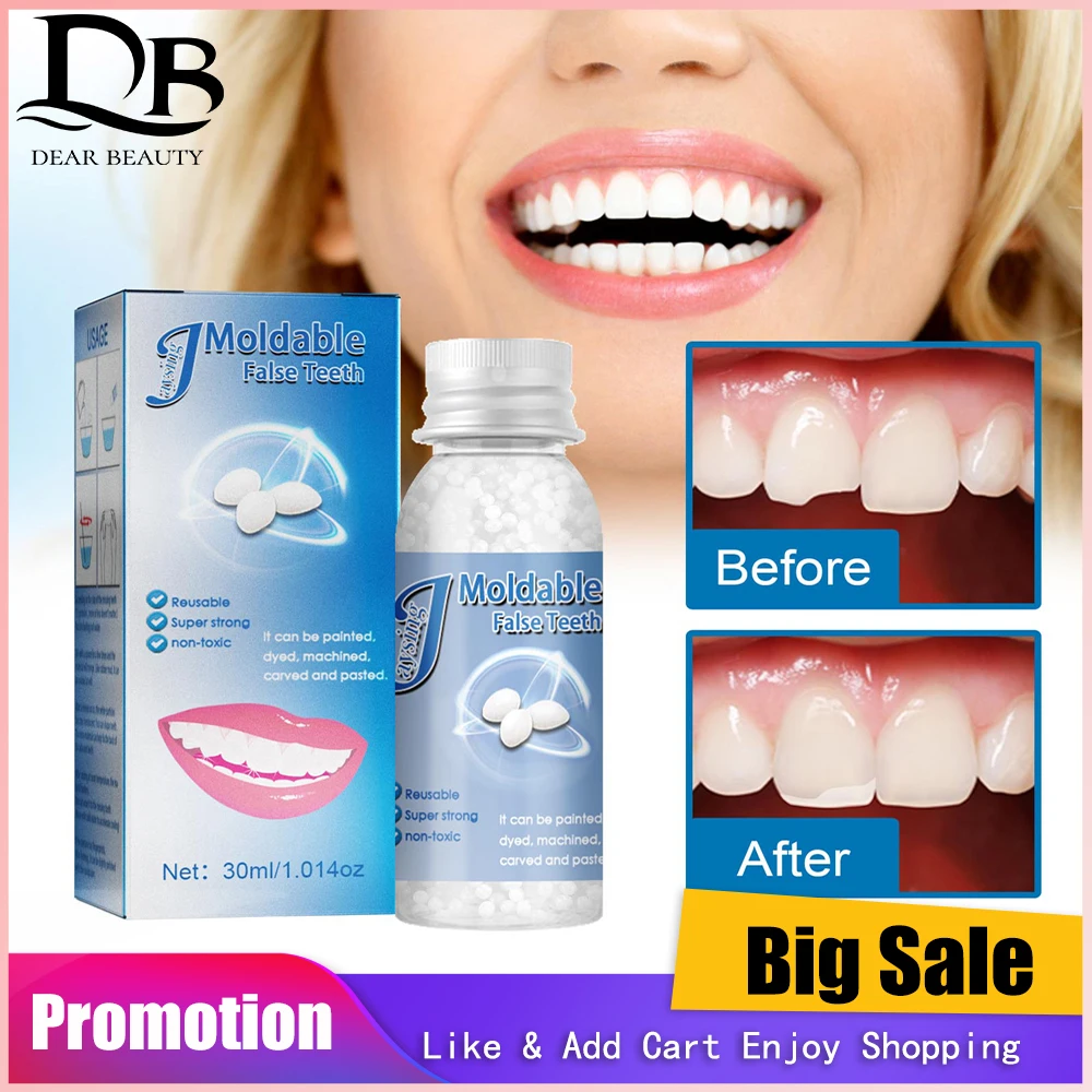 30ml-Dental-Resin-Shapeable-Teeth-Glue-Makeup-Dentures-Modification ...
