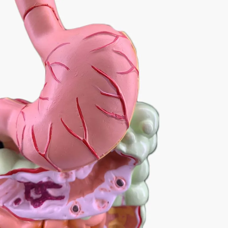 Large Intestine Anatomy Model