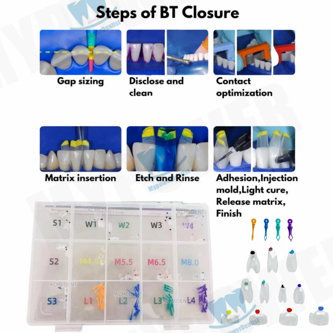 Matriz-transparente-Dental-cu-as-de-Diastema-Similar-a-Matrice-BioClear-1Kit.png