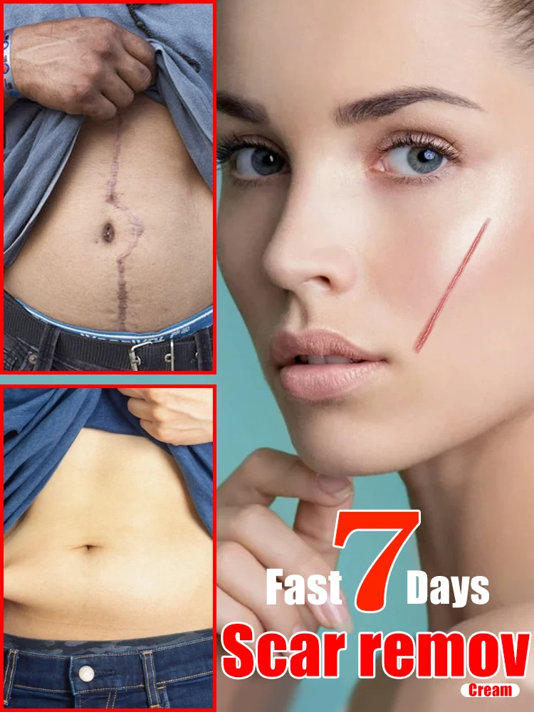Scar-removal-damaged-skin-scars-repair-postal-operative-scar-imprint ...