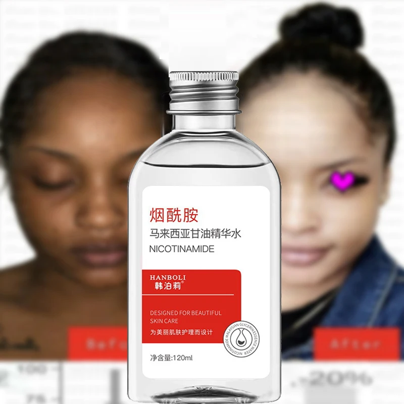 Niacinamide Malaysian Glycerin Liquid Brighten Skin Colour Dryness ...