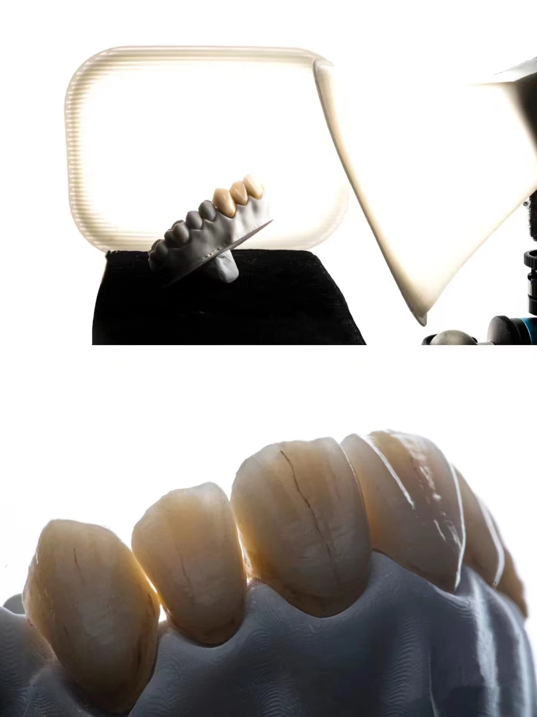 Double-Flash-Soft-Light-Studio-Clinical-Oral-Black-and-White-Background ...