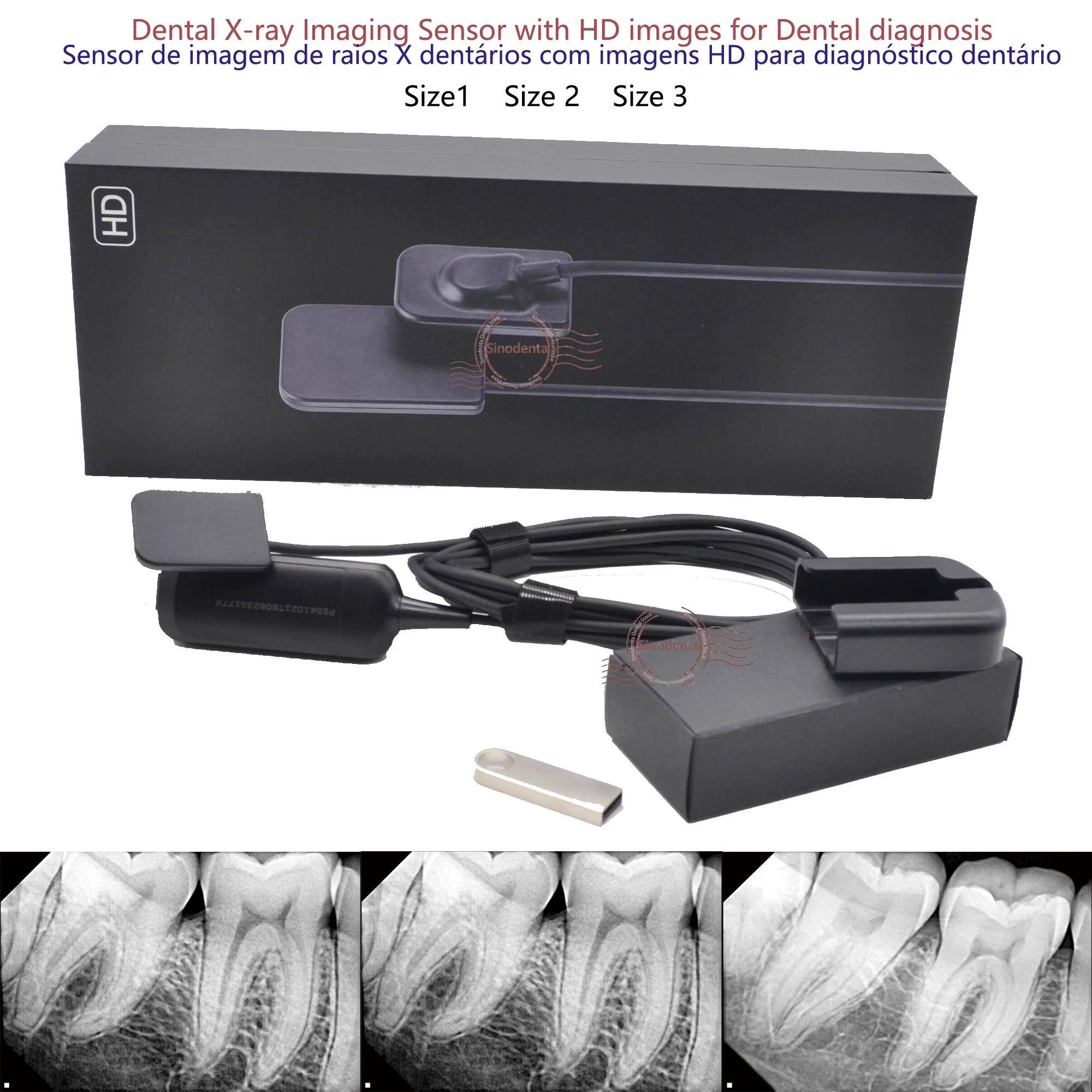 Cmos Dental Digital Radiography