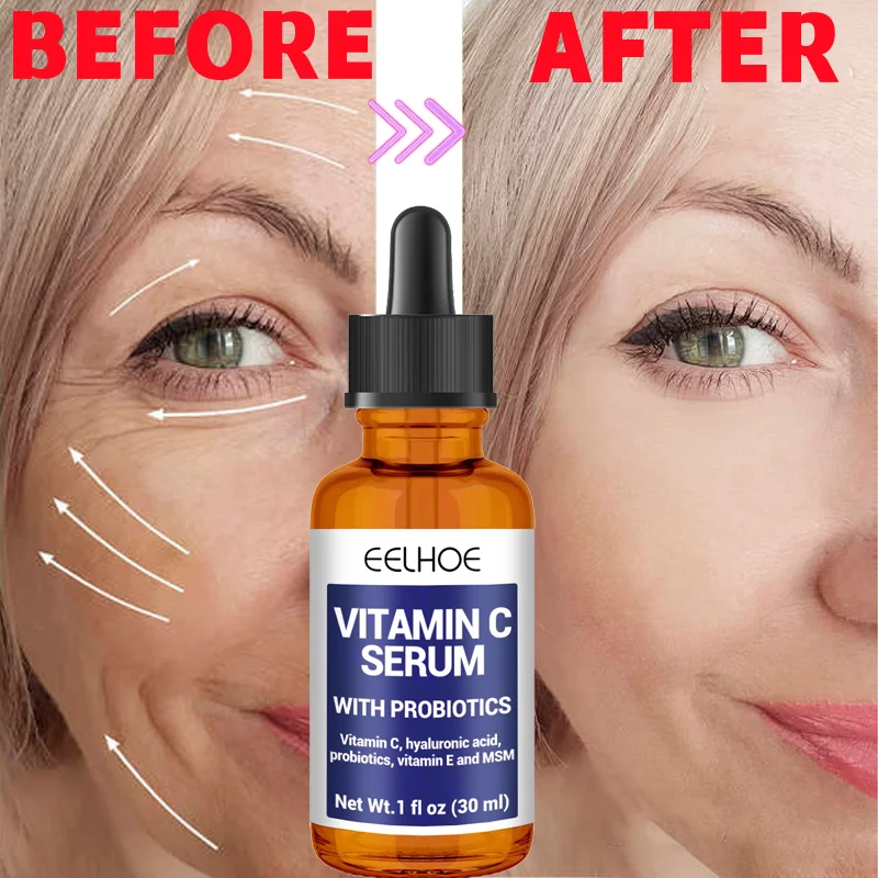 Aceite de esencia Facial reafirmante, suero Facial antienvejecimiento, eliminador de arrugas ...