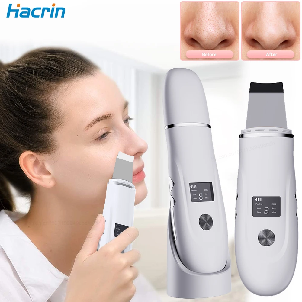 Blackhead-Remover-Electric-Pore-Face-Cleaner-Pimple-Acne-BlackHead ...