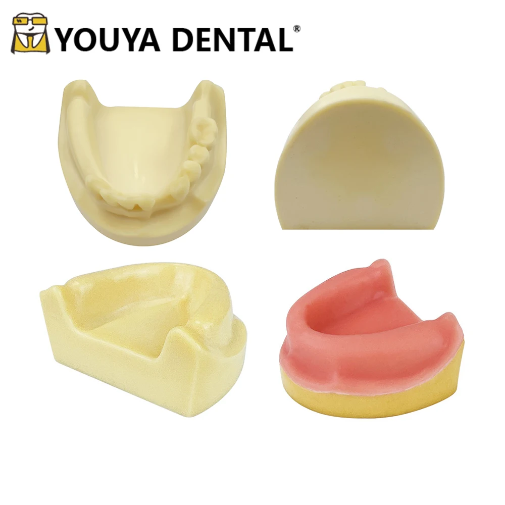 Dental-Maxillary-Implant-Model-Mandibular-Tooth-Missing-Implant ...
