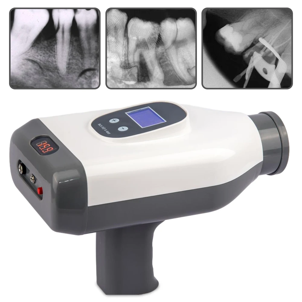 Dental X -ray portable Dental Office Digital X Ray Diagnostic Dental ...