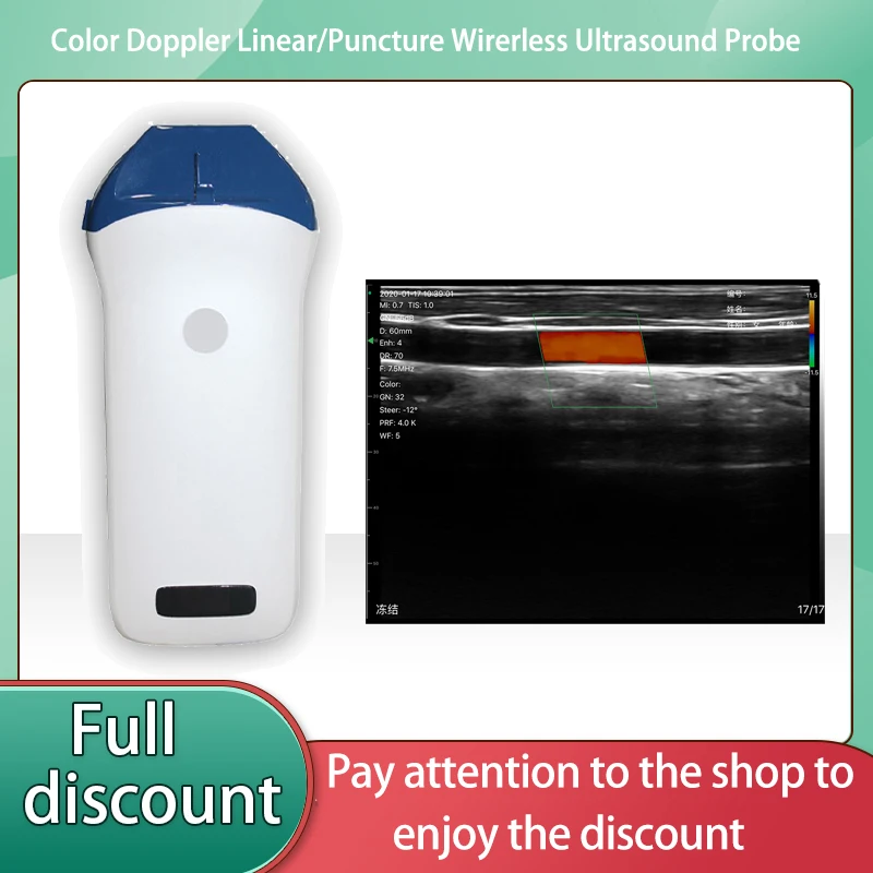 Amain-MagiQ-LW5PC-gu-a-de-punci-n-Doppler-de-Color-lineal-sonda-de ...