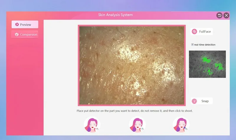 WIFI Wireless Portable Skin Aesthetic Analyzer Digital Skin Scanner ...