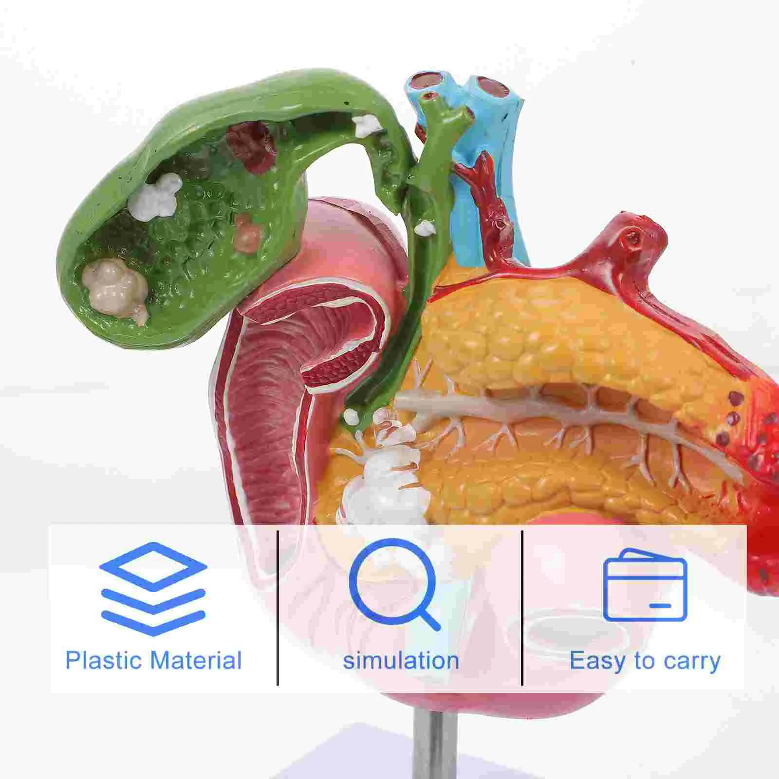 Pathological Model of Gallbladder Anatomy Study Tool Biology Teaching ...