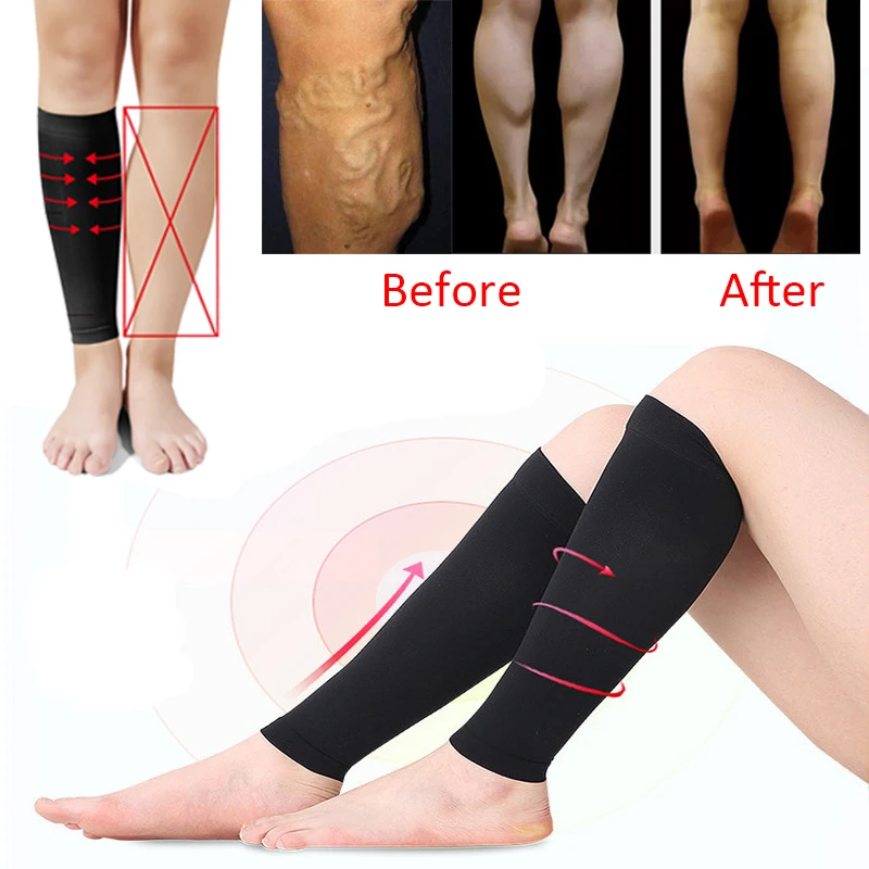 Elastic-Knee-High-Stockings-Calf-Compression-Stockings-Varicose-Veins ...