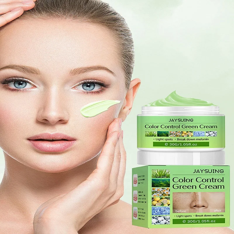 Whitening-Freckles-Cream-Face-Remove-Melasma-Dark-Spots-Lighten-Melanin ...