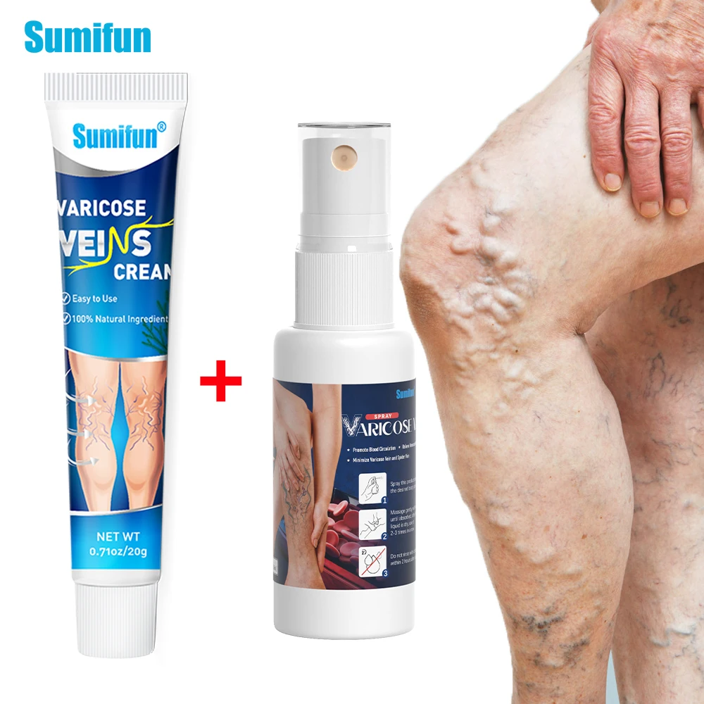 Sumifun-Pommade médicale pour varices, 2types, vascularite, phlébite ...