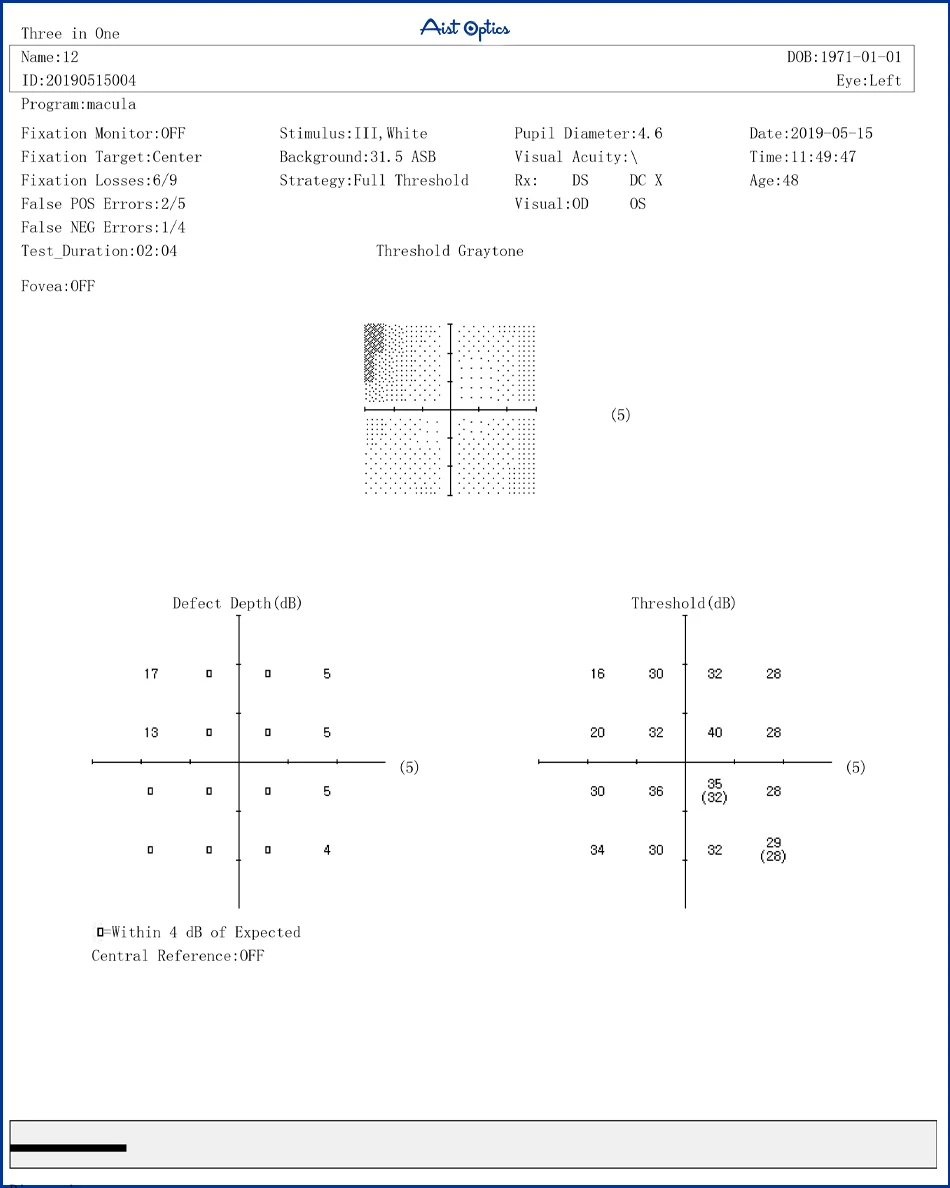 BIO-1000 Auto Perimeter,Perimeter