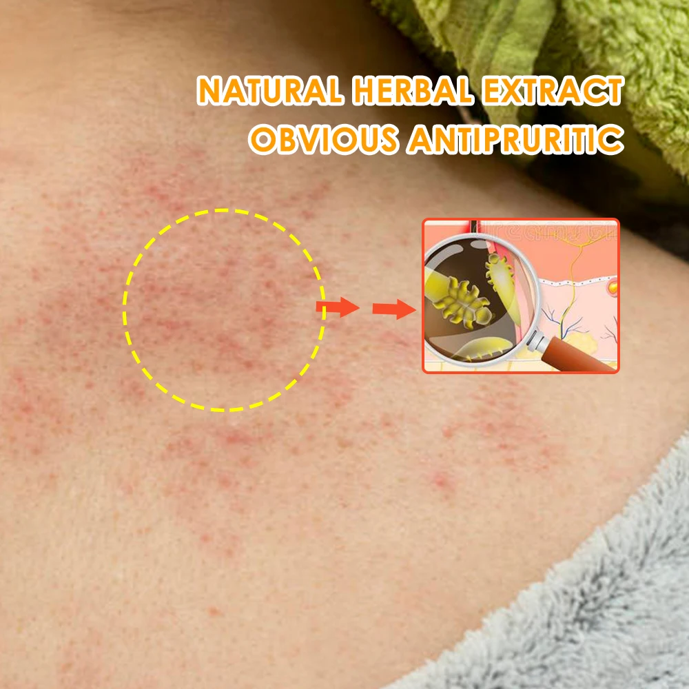 Folliculitis Treatment At Home