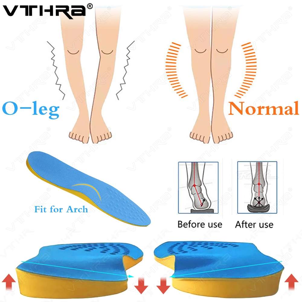 VTHRA Orthotic Insoles XO Legs for Support Shoes Inserts Outer Eight ...