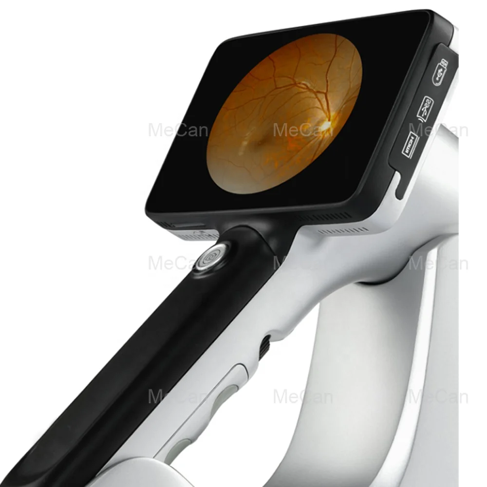 Fundus-Camera-Handheld-Retinal-Pet-Eye-Portable-Fundus-Camera.jpg