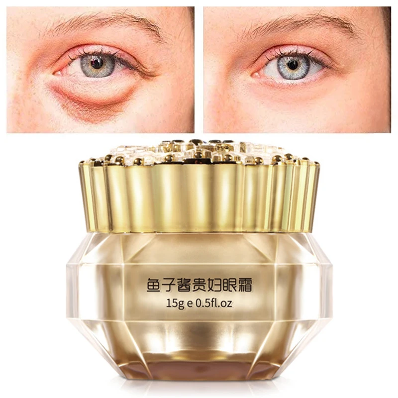 Eye Cream Remove Dark Circles Lightens Fine Lines Brighten Improve ...