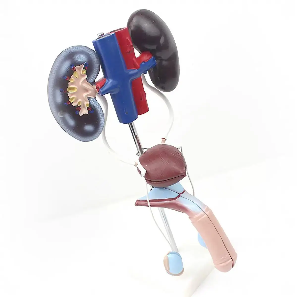 3-Parts-Human-Male-Stereourinary-Kidney-Ureter-Bladder-Model-Surgeon ...