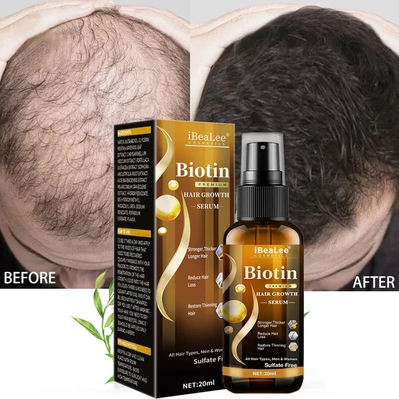 Hair-Growth-Products-Biotin-Fast-Growing-Hair-Care-Essential-Oils-Anti ...