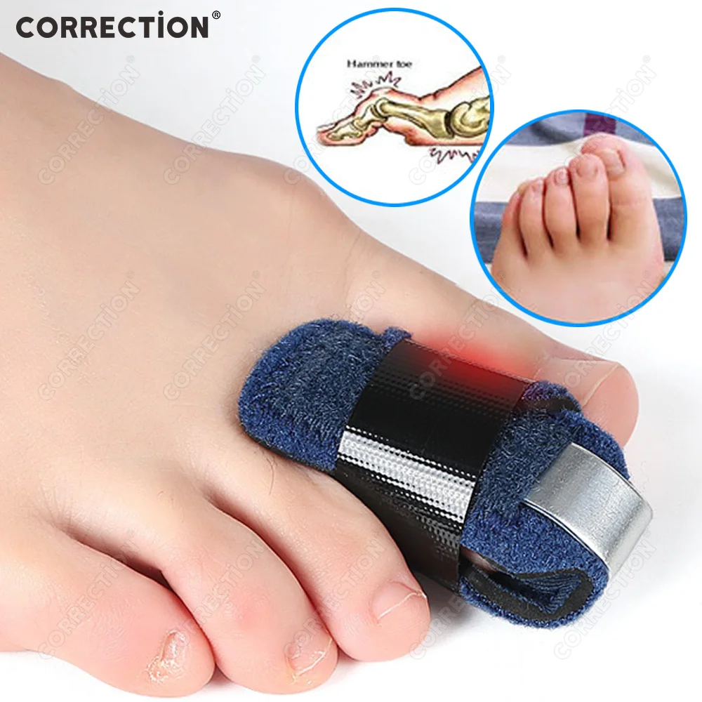 Toe-Straightener-Toe-Splint-For-Hammer-Toe-Corrector-Crooked-Toe-Claw ...