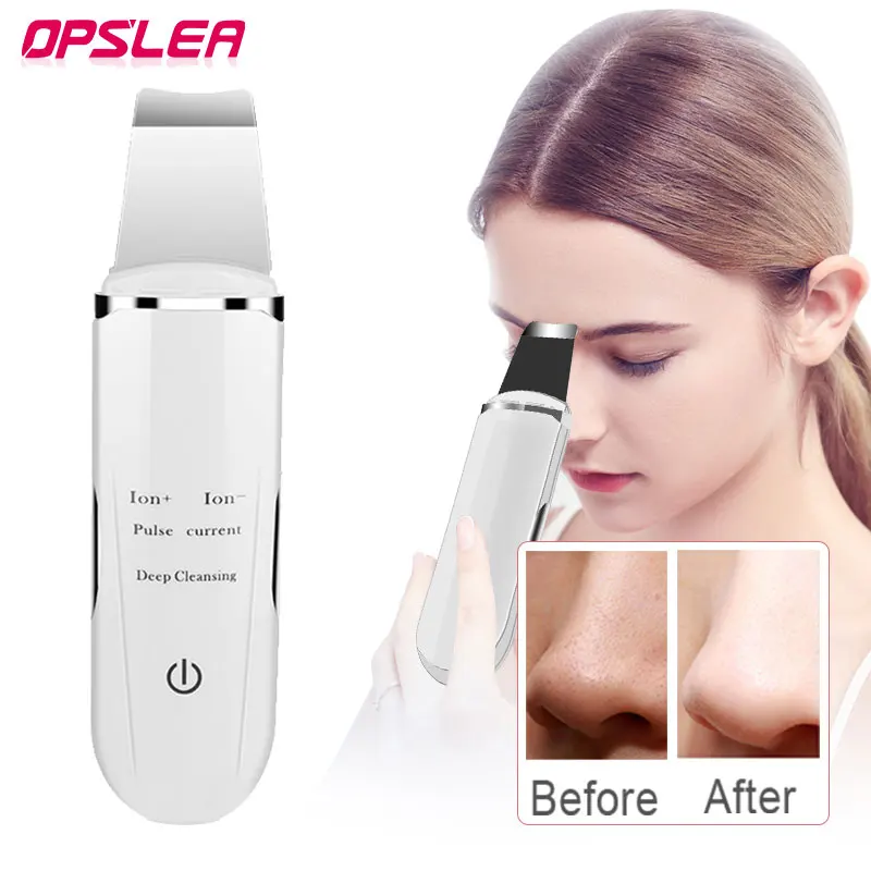 Ultrasonic-Skin-Scrubber-Vibration-Face-Spatula-Blackhead-Remover ...