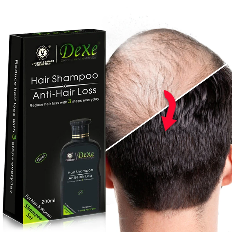 200ml Dexe Hair Anti Hair Loss Shampoo Chinese Herbal Hair Growth ...