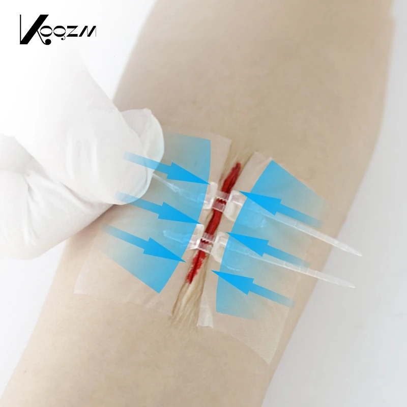 1/2Pcs Zipper Tie Wound Closure Patch Hemostatic Patch Wound Fast ...