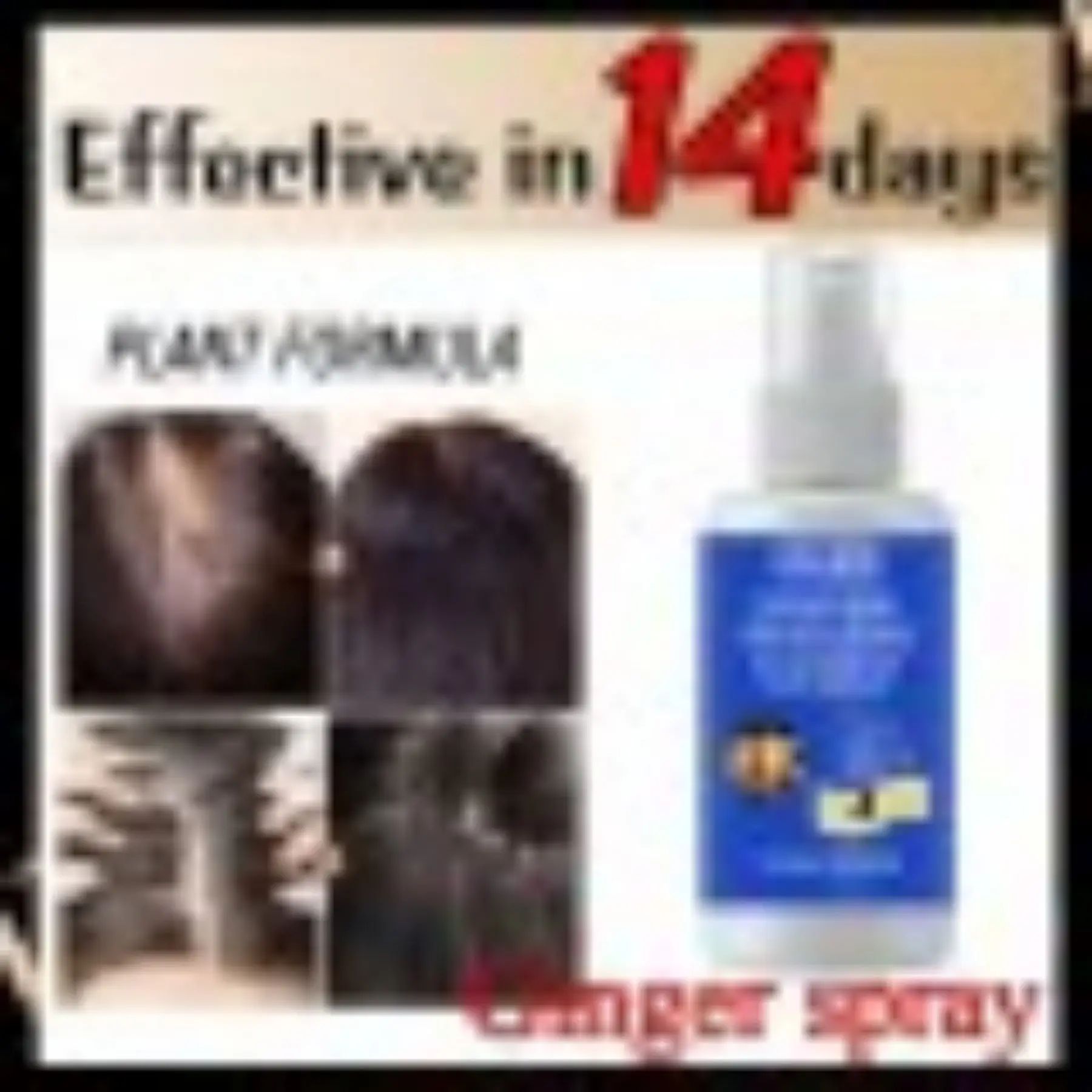2022-Ginger-Hair-Grower-spray-Anti-Hair-Fall-Hair-Loss-Treatment-Hair ...