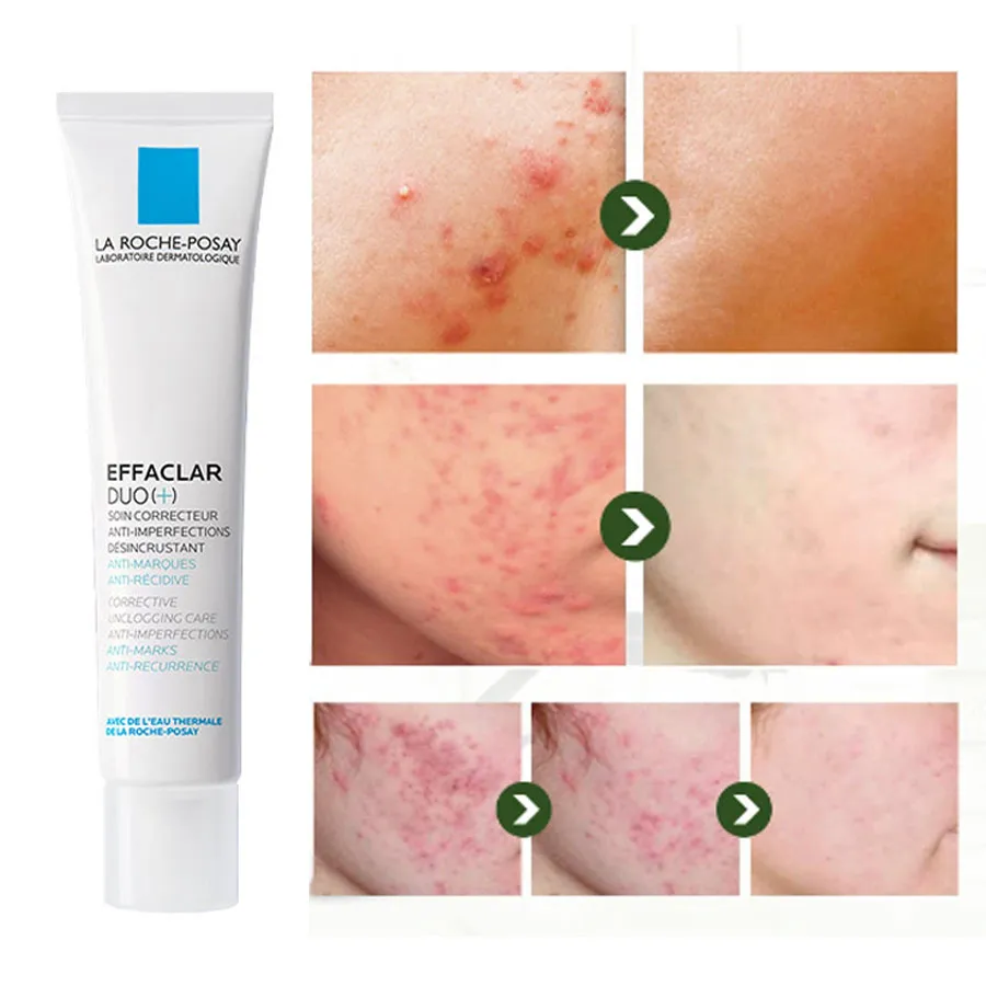La Roche Posay EFFACLAR DUO + إزالة الرؤوس السوداء علاج حب الشباب هلام ...