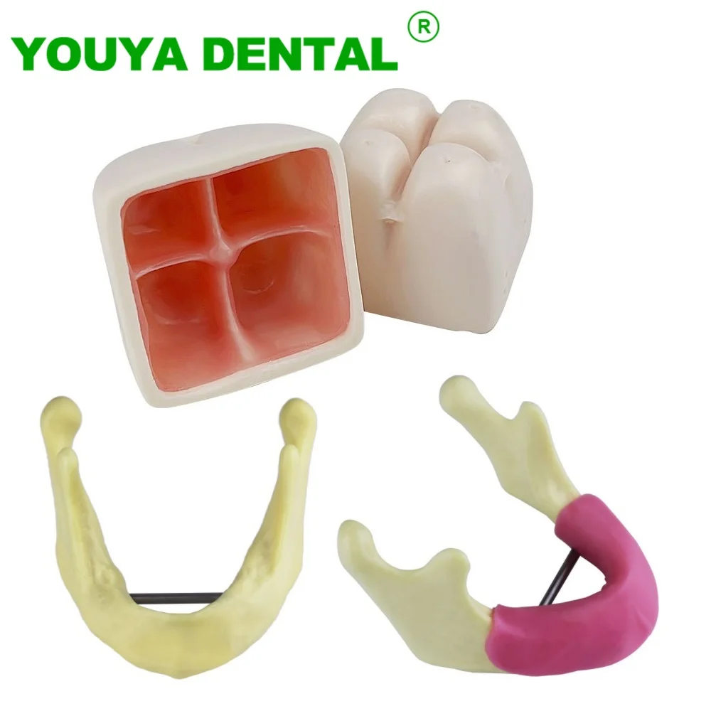 Mod-le-d-implant-dentaire-pour-la-pratique-sinus-maxillaire-dents ...