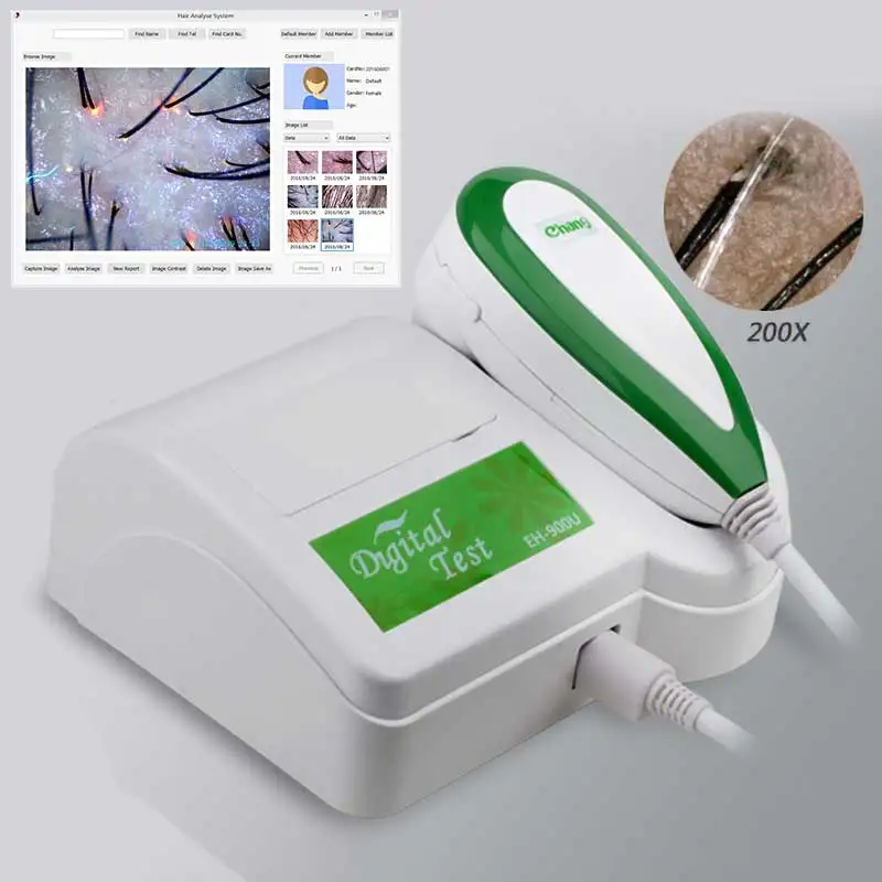 Hair Follicle Detection Hair Analyzer With Member Management Storage