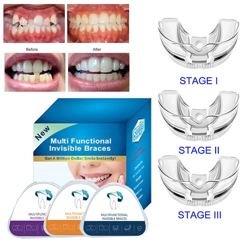 3pcs-set-Orthodontic-Braces-Invisalign-Full-Stage-Dental-Braces-Smile ...