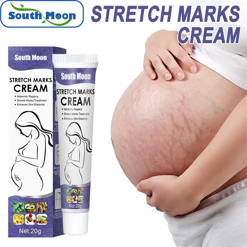 Pregnancy Repair Cream Stretch Mark Removal Acne Scar Maternity Stretch ...