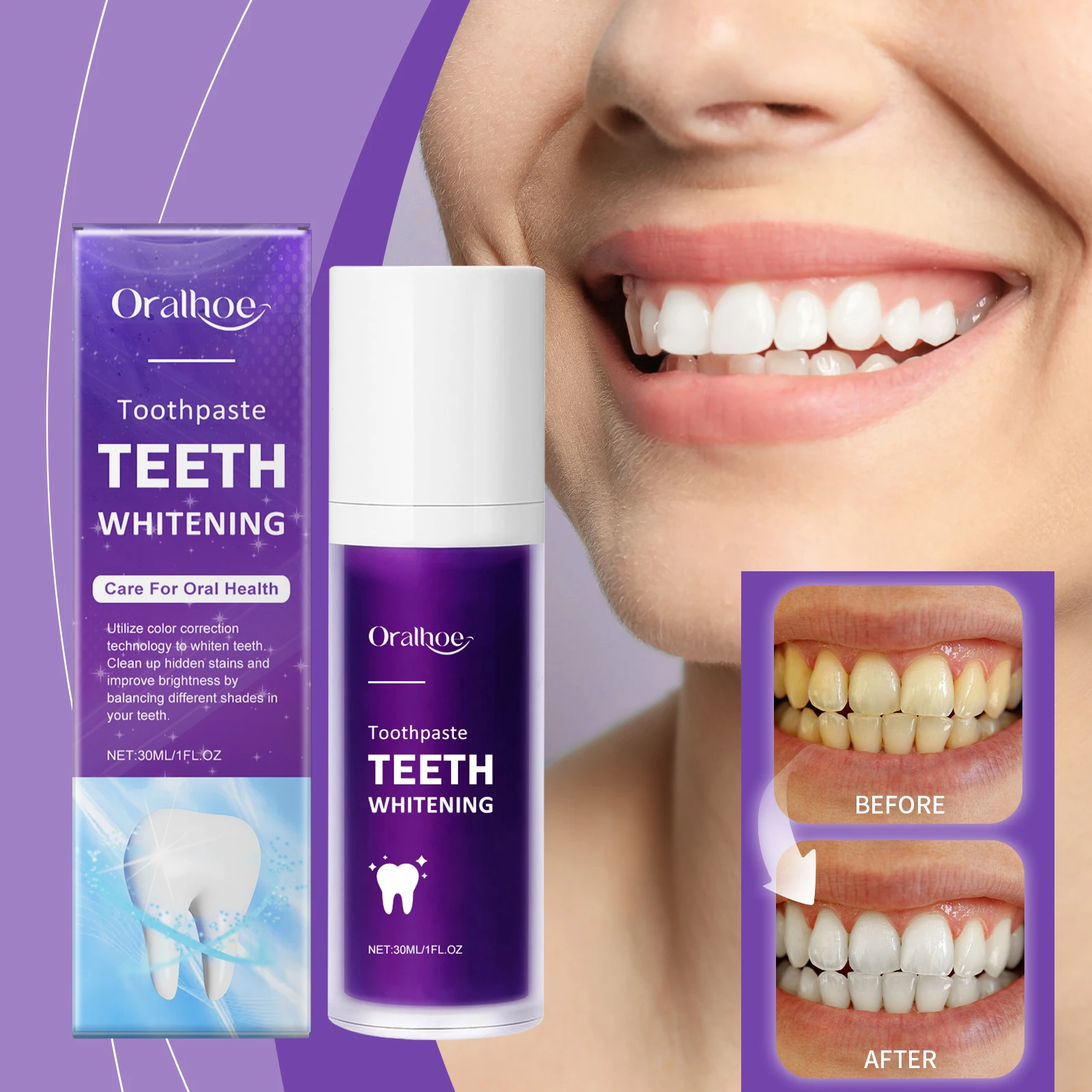 Acid Erosion Teeth Repair: The Ultimate Guide to Restoring Your Smile ...