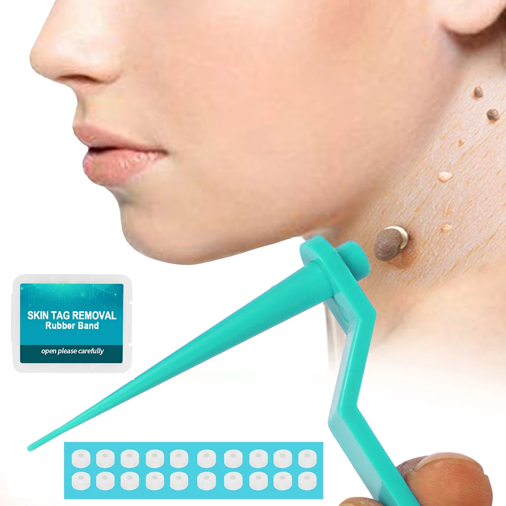 1set-Micro-Natural-Painless-Skin-Tag-Rubber-Band-Mole-Removal-Wart-Skin ...