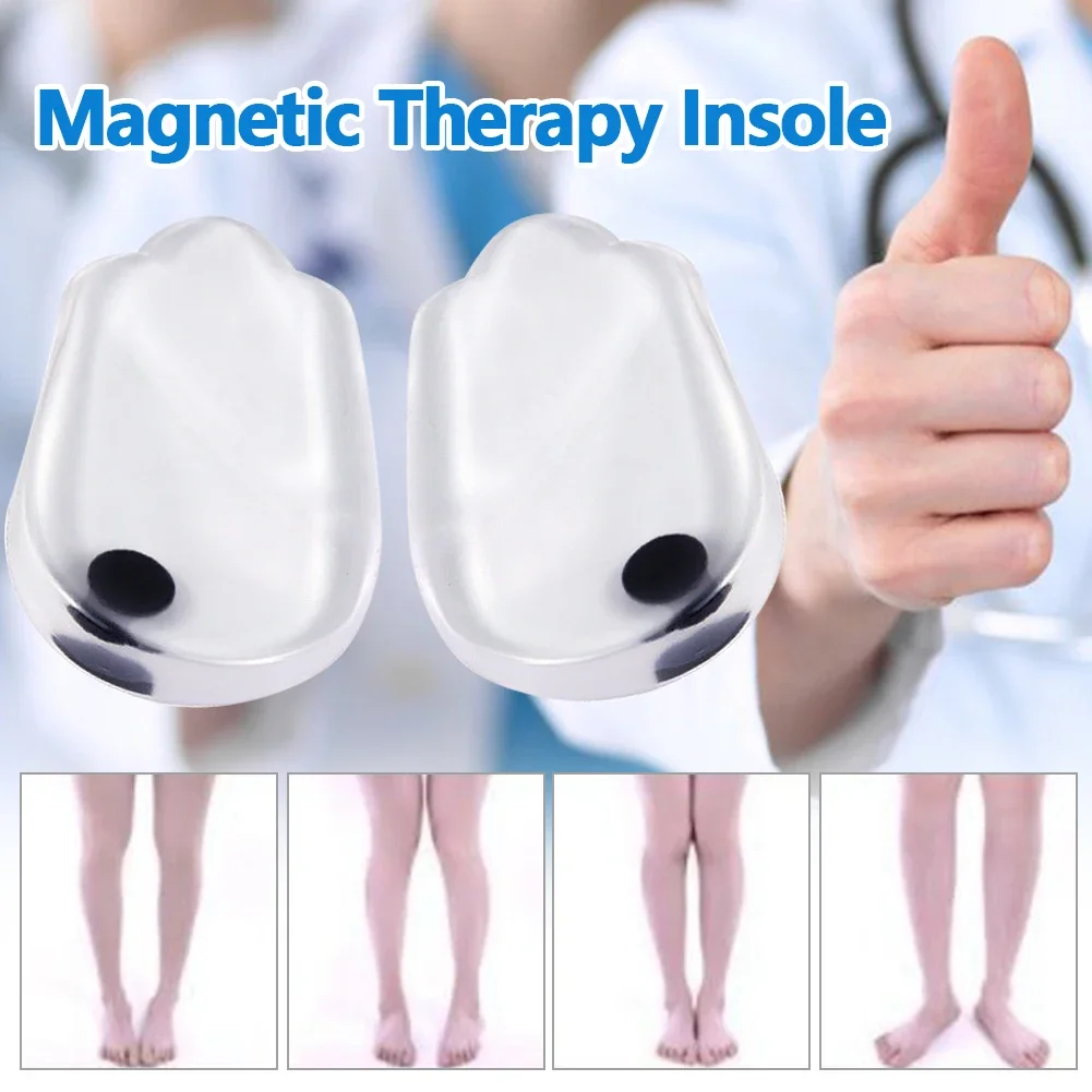 O-X-Type-Leg-Correction-Shoe-Heel-Pads-Silicone-Bowed-Legs-Knee-Valgum ...