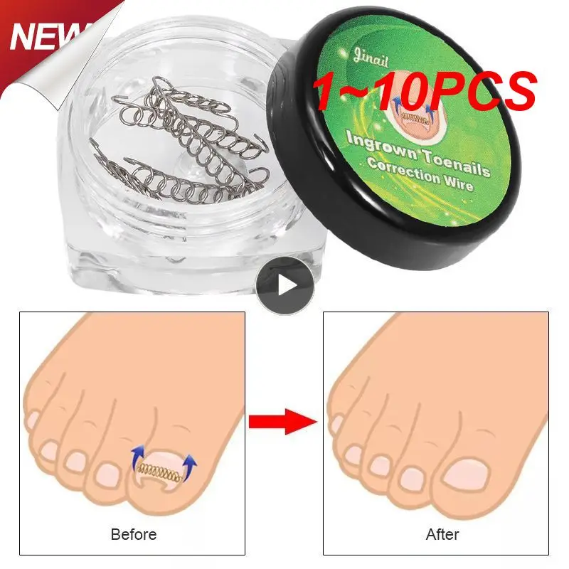 1-10PCS-Ingrown-Toenail-Correction-Tool-Invisible-Ingrown-Toe-Nail ...
