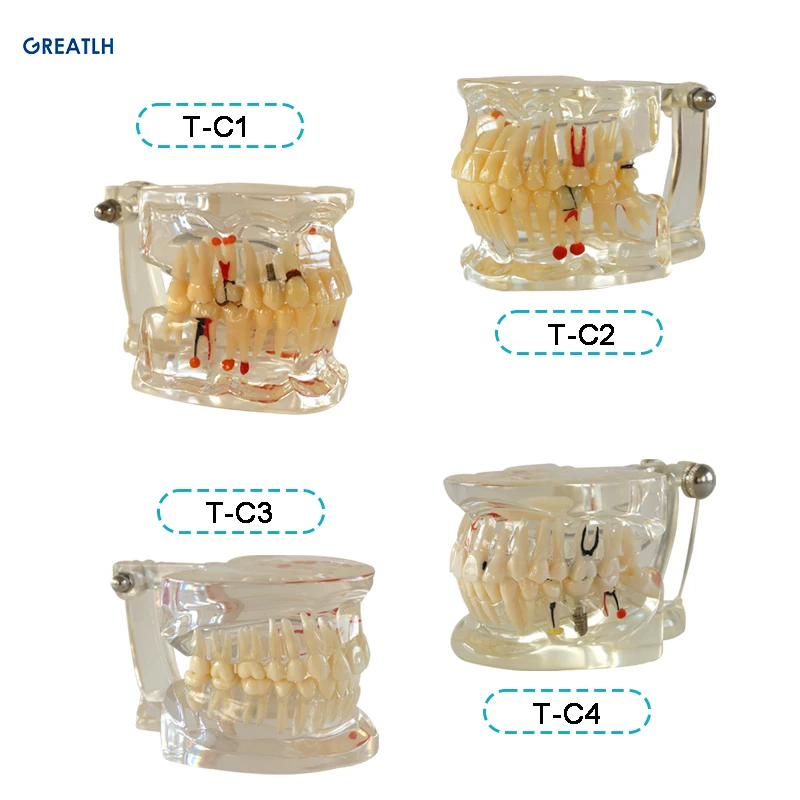 Modelo Dental modelo de dientes modelo de enseñanza de dientes de goma ...