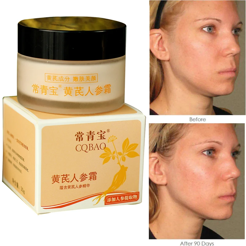 Chinese Medicine Astragalus 20% Whitening Anti-wrinkle Moisturizing ...