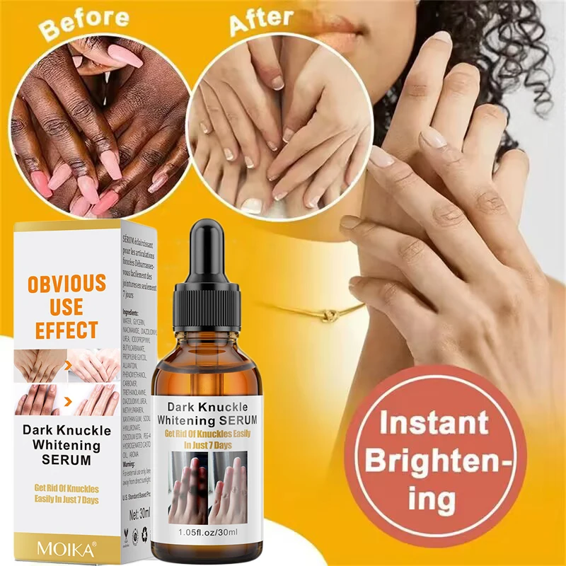 Dark-Knuckles-Fast-Whitening-Serum-Hand-Knuckle-Elbows-Knee-Melanin ...