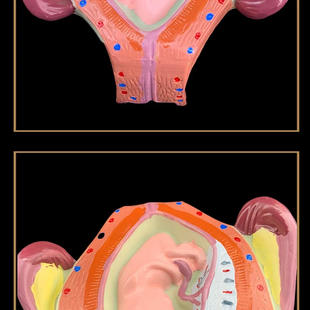 Pelvic Model Anatomy Female Teaching Embryo Model Full- Term Fetus ...
