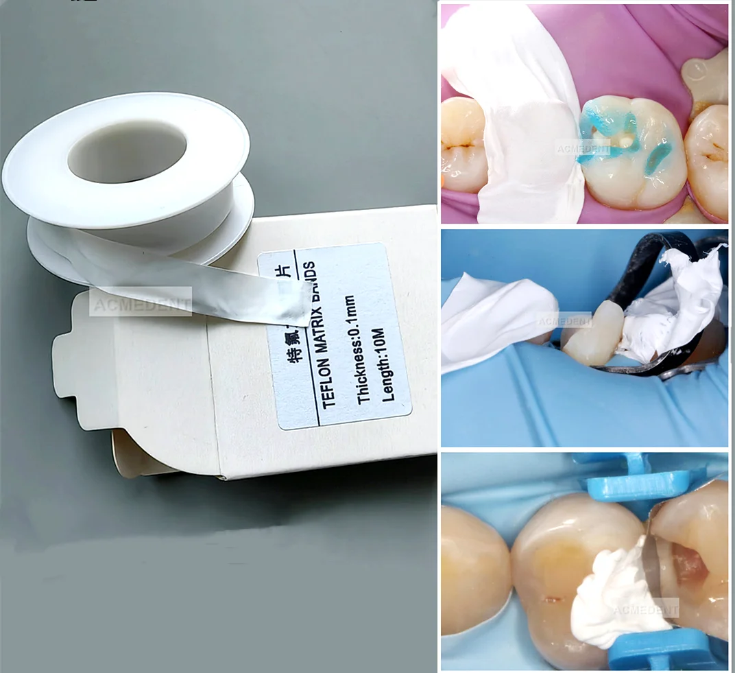 Dental Matrix Bands PTFT White Universal Matrices System White Material ...