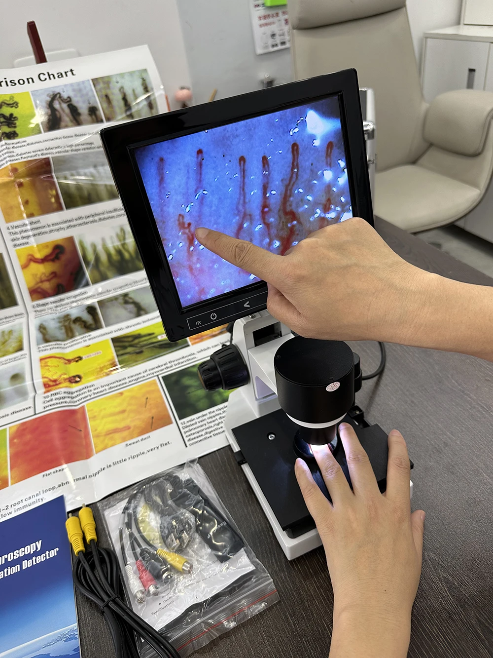 Free Shipping Healthcare Beauty Device Fingernail Capillaroscope ...