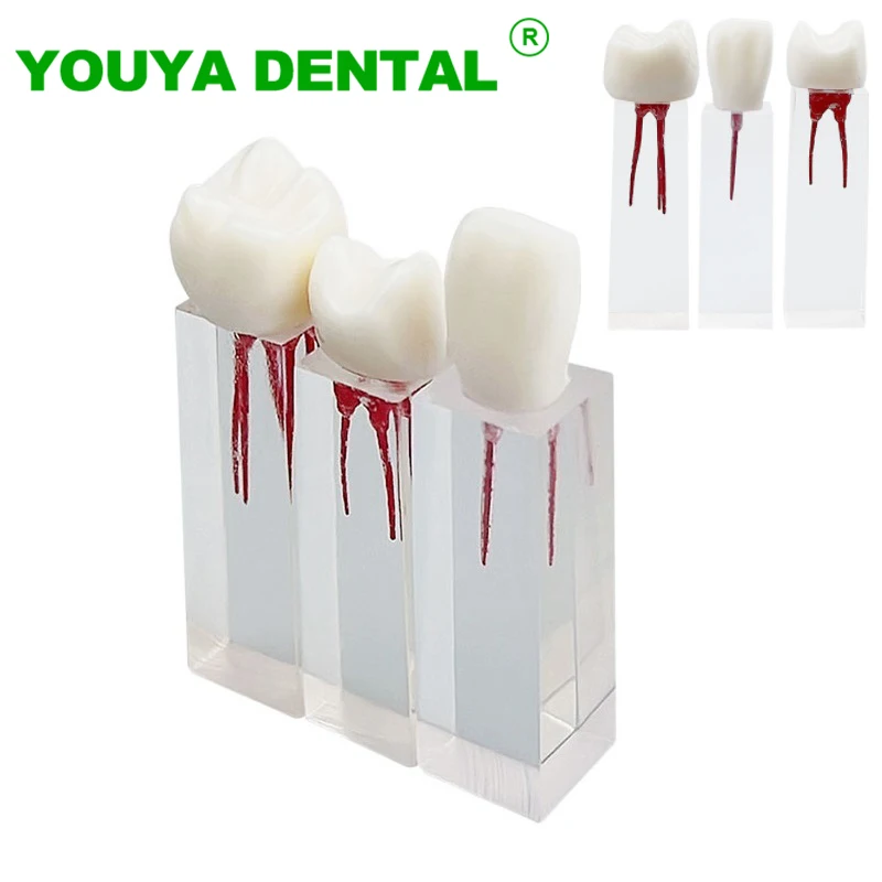 Modelo de estudio de enseñanza endodóntica Dental, modelo de Canal ...